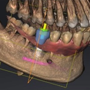 Nigar Ahmadbayli – Moderne Zahnmedizin in Hildesheim